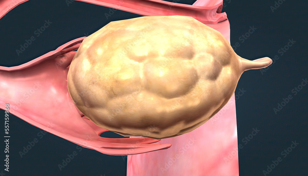 The ovaries are small, oval-shaped glands located on either side of ...