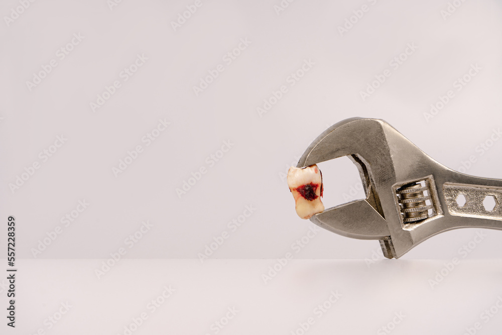 Tooth extraction with dental tools with caries by a professional ...