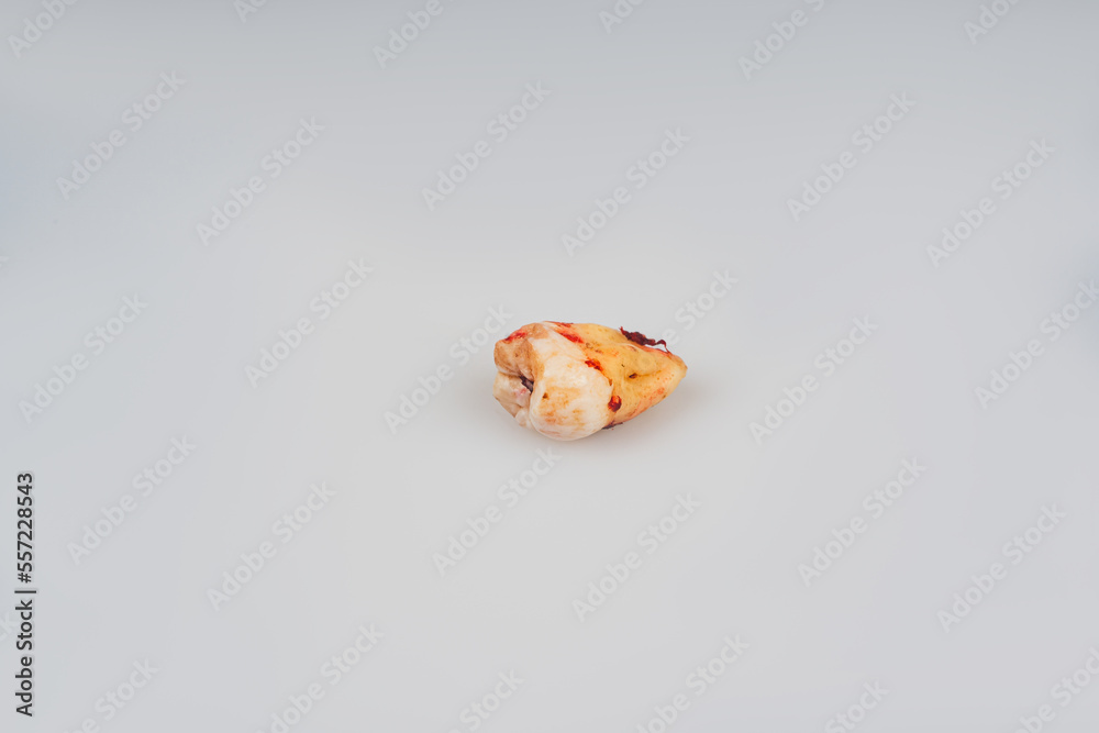 Human wisdom tooth isolated on gray background. Dentistry concept ...