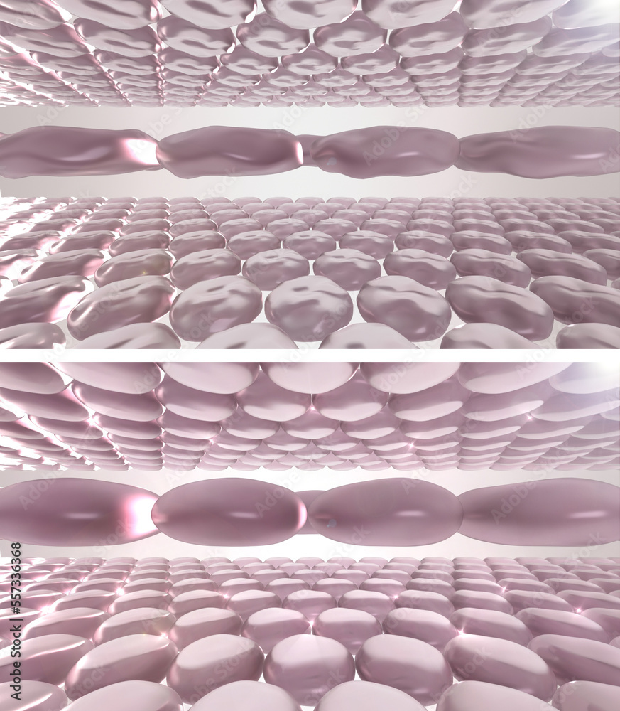 Skin fibers cells before and after renovation and volumizing action of ...