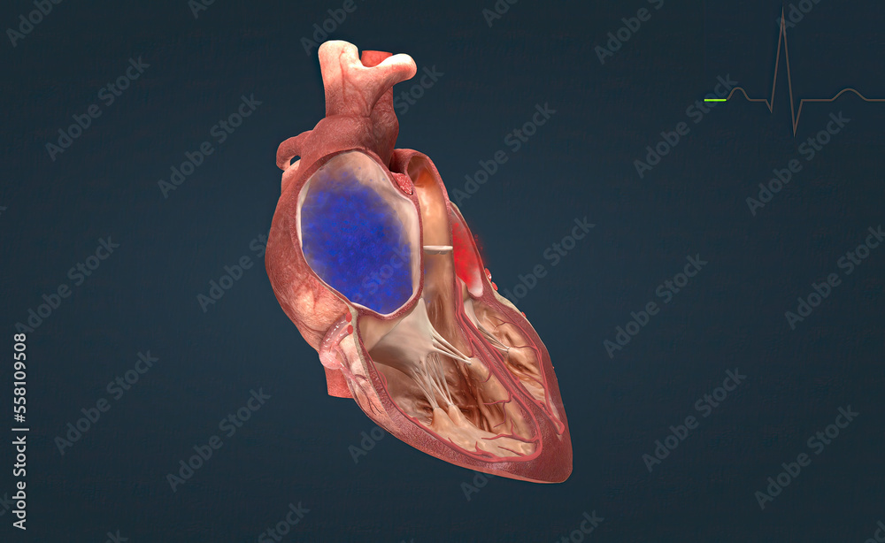 Cardiac Conduction The heart conduction system is the network of nodes ...