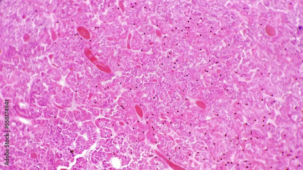 Human pituitary gland in cross section filmed under microscope with ...