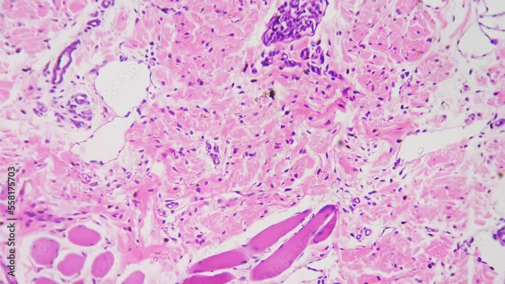 High magnification of human lip in section 200 filmed under microscope ...