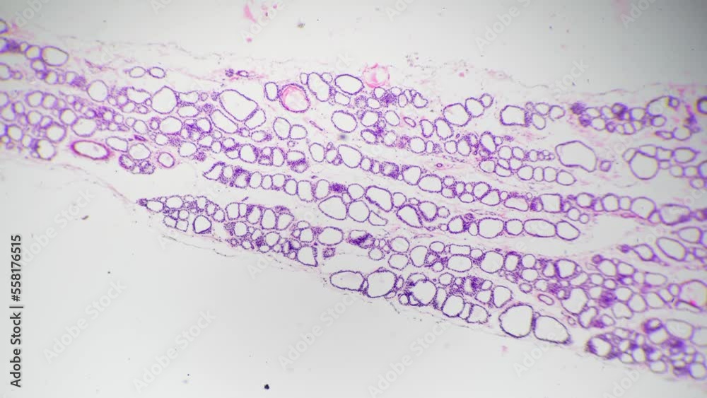 Video Stock Human thyroid gland in section magnified in 40 times under ...