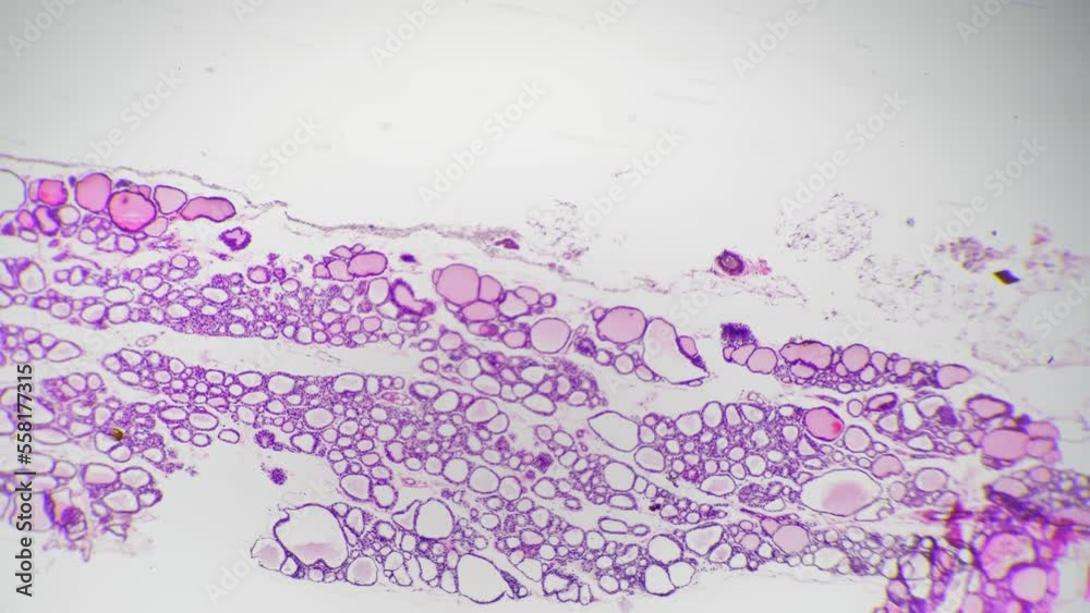Parathyroid cells in section of the human shown with high magnification ...