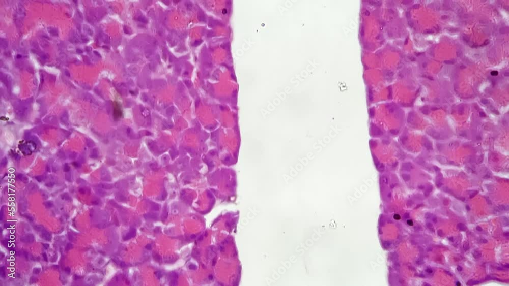 Thymus gland section of human filmed with high magnification 400x on ...