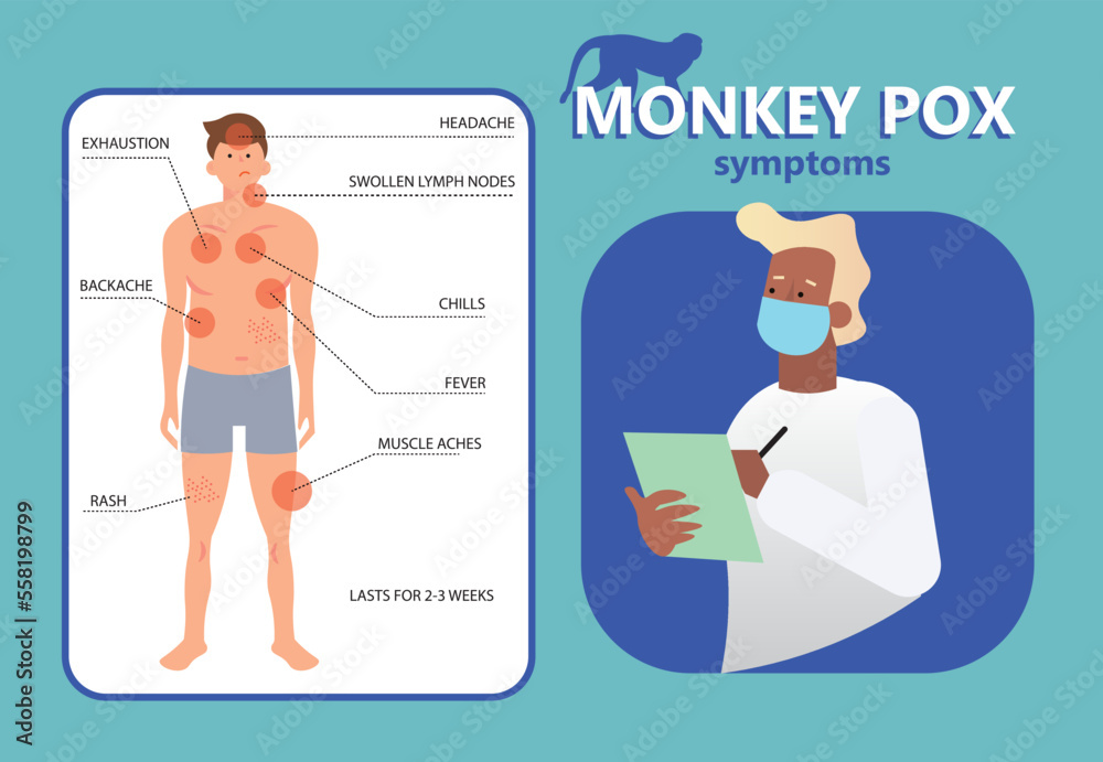 Monkeypox virus infographic with common clinic symptom. Vector ...