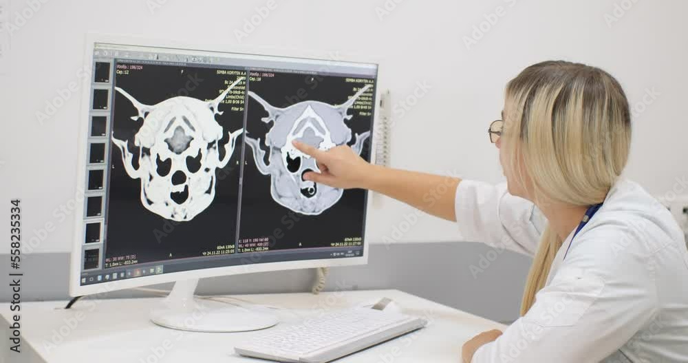 On the computer screen magnetic resonance imaging of a cat. The doctor ...