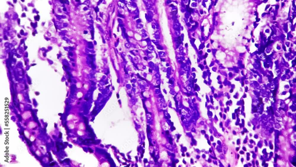 Section of human duodenum in high magnification 400x filmed under ...