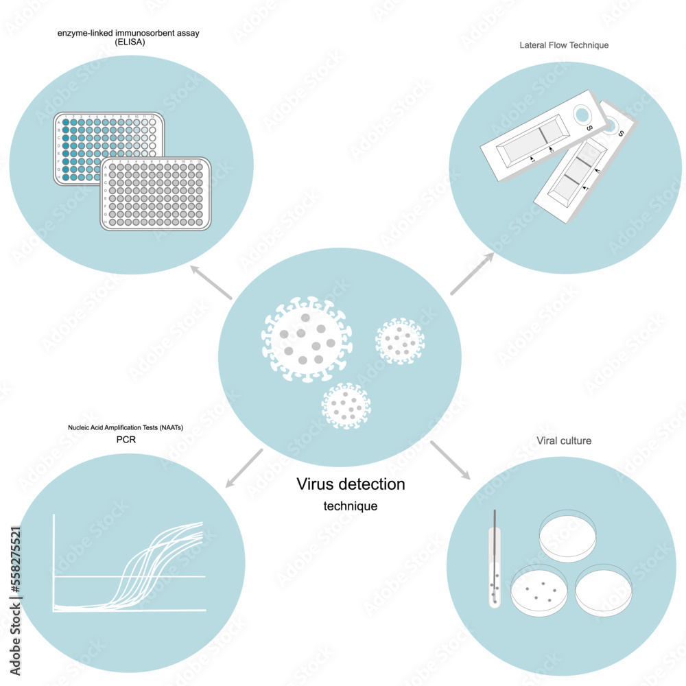 The virus detection technique:enzyme-linked immunosorbent assay (ELISA ...