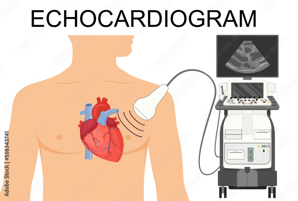 Vetor de Echocardiogram. Heart ultrasound. Medical Vector illustration ... Vetor de Echocardiogram. Heart ultrasound. Medical Vector illustration ...
