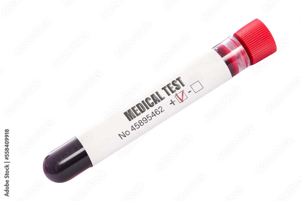 Single blood test tube with sample generic text on the sticker isolated ...