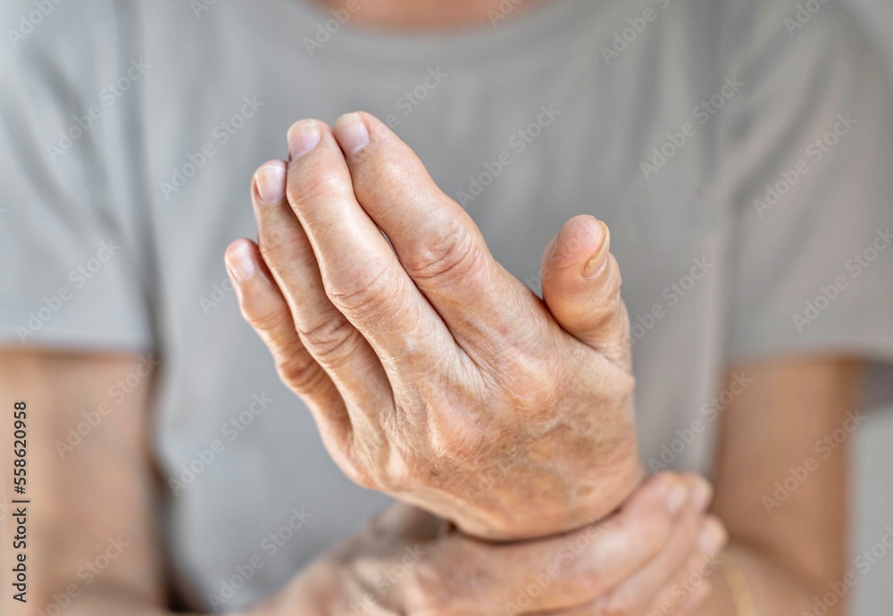 Inflammation of hand joints. Concept of rheumatic arthritis, rheumatism ...