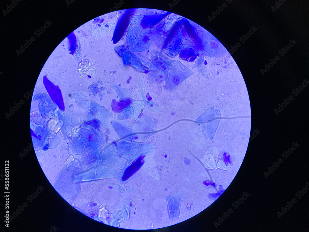 Foto de Microscopic view of Malassezia pachydermatis cells taken from ...