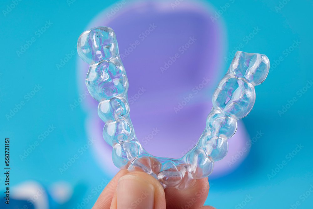 dental hygiene, orthodontic treatment, occlusal splint Stock Photo ...