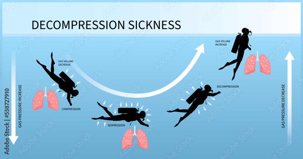 Accident while diver high oxygen gas loss of appetite and Henry's ...