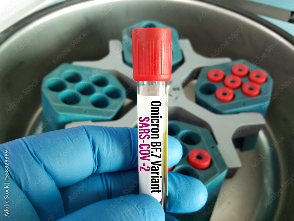 Blood sample for Omicron BF.7 variant test. New variant of the SARS-CoV ...