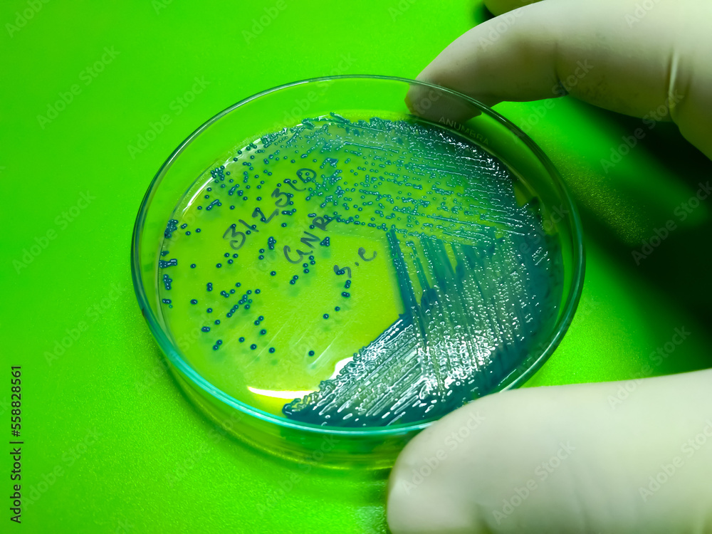 HiCrome UTI Agar media pure growth of Escherichia coli or E.coli ...