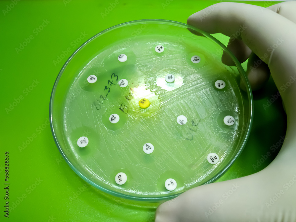Antimicrobial susceptibility testing in culture plate. Drug sensitivity ...