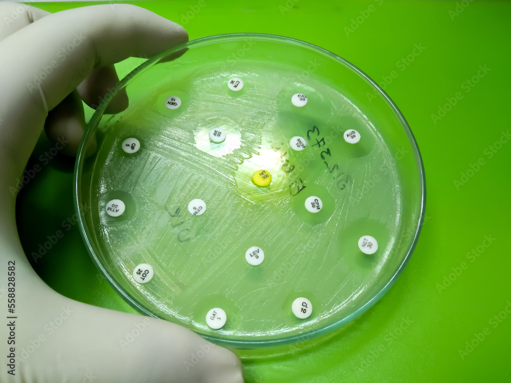 Antimicrobial susceptibility testing in culture plate. Drug sensitivity ...