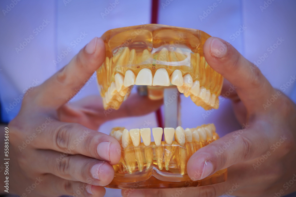 The doctor’s hands hold an artificial model of the jaw with breaks. The ...