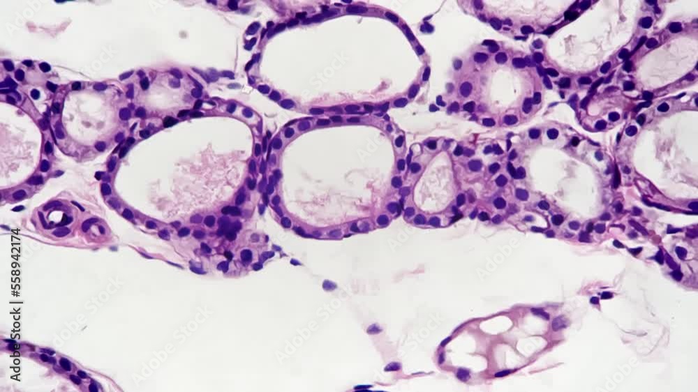 Parathyroid cells magnified in 400 times on white background for ...