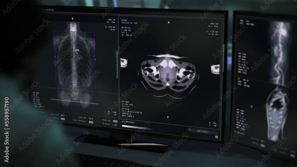 Video Stock Performing medical examination of the human body for injury ...