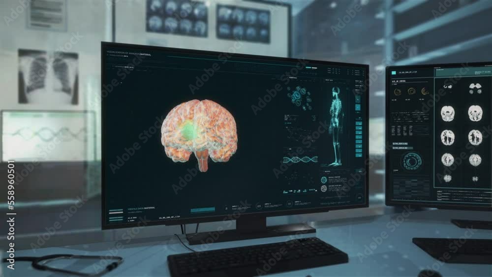 Anatomical Patients Health Data Scanned By Modern Examination System ...