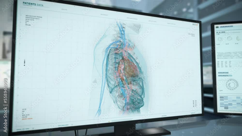 Scanning Chest Of Patient For Heart Organ Analysis. Medical Analysis ...