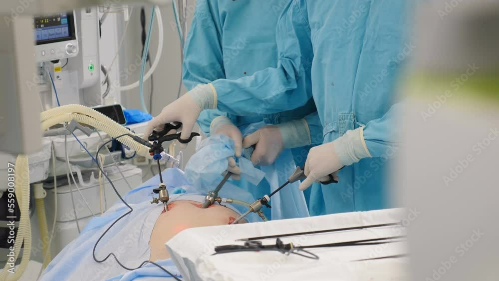 Laparoscopic cholecystectomy instrument. Real Surgery, abdominal ...