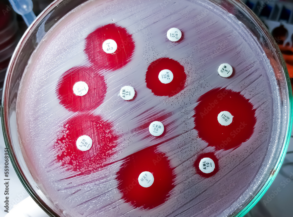 Antimicrobial susceptibility testing in petri dish. Antibiotic ...