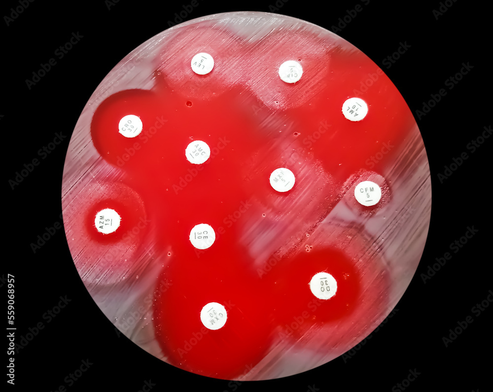 Antimicrobial susceptibility testing in petri dish. Antibiotic ...