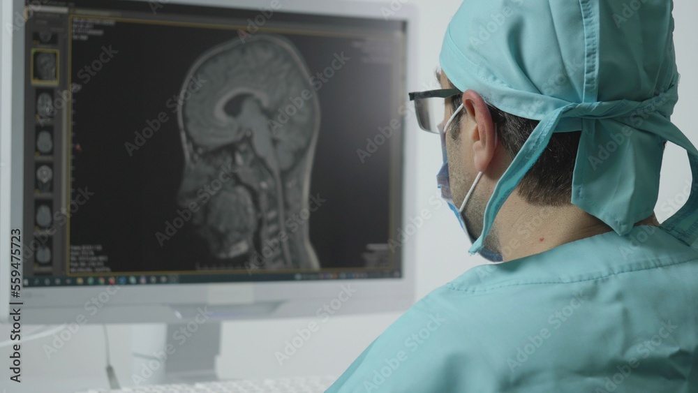 Medical doctor studying patient brain MRI on computer Stock Photo ...
