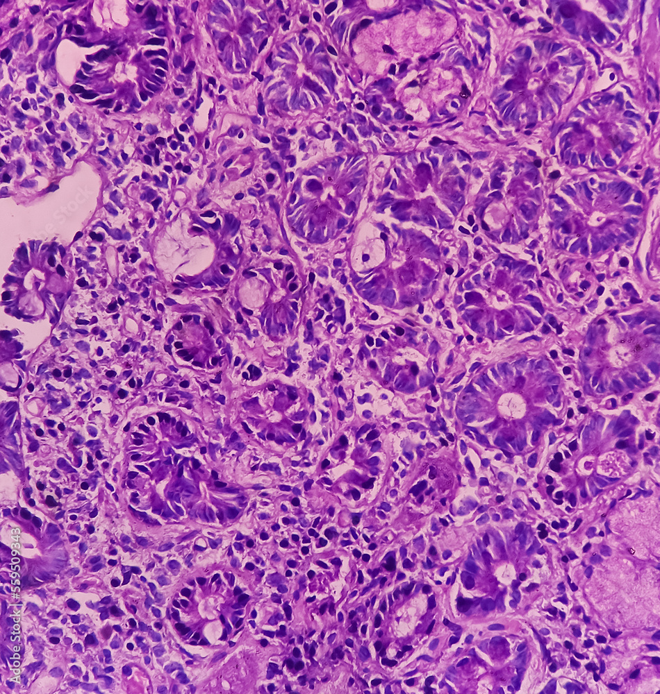 Light micrograph of wall of the small intestine (duodenum) showing ...