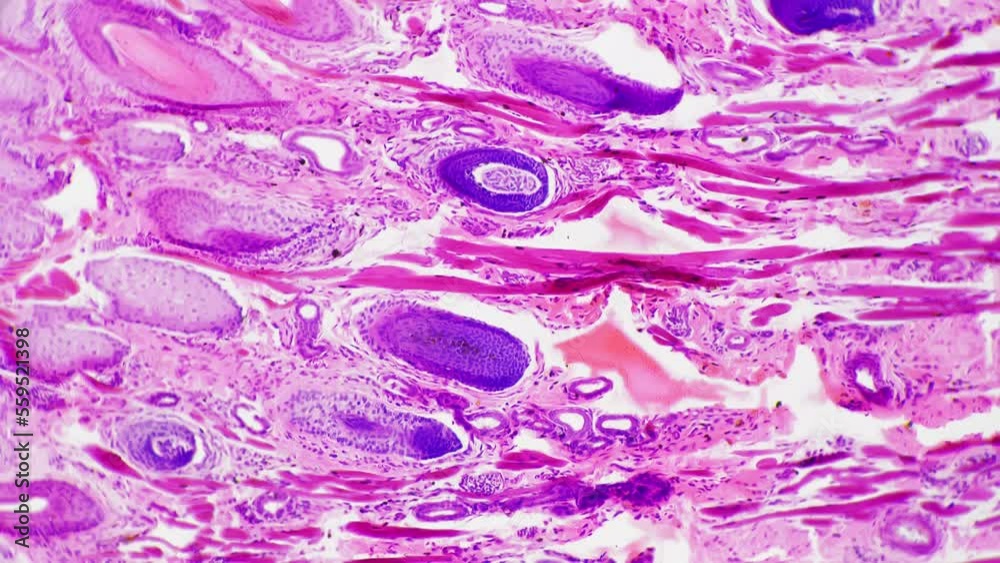 Section of human lip filmed under light micrograph with high ...