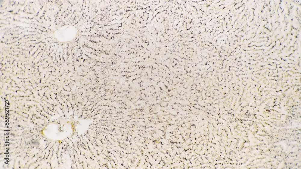 Human cholangiole in section filmed under microscope 100x against white ...