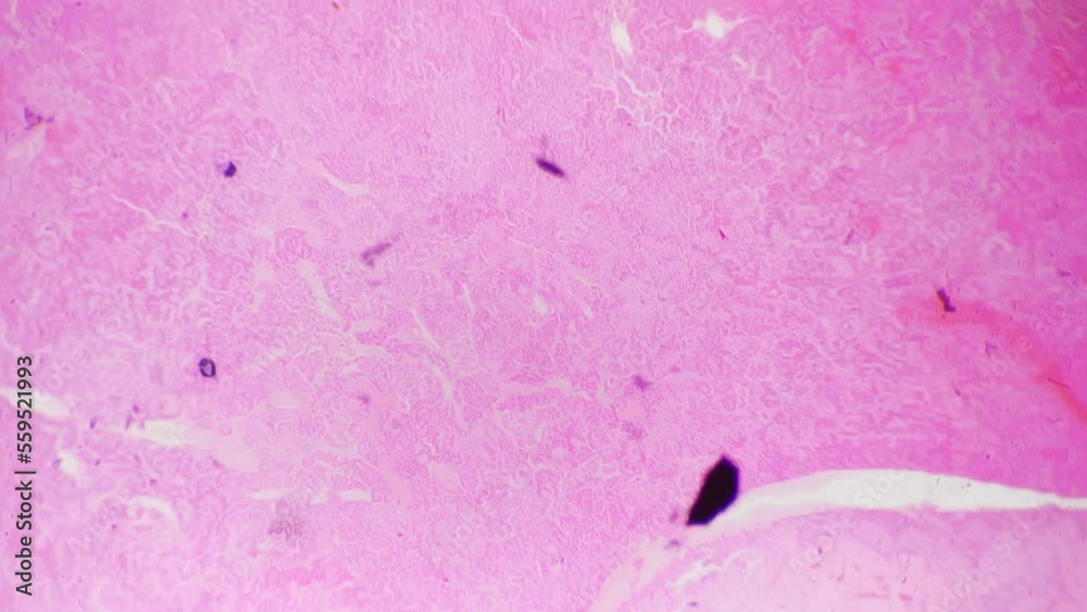 Pituitary gland of the human in cross section filmed under microscope ...