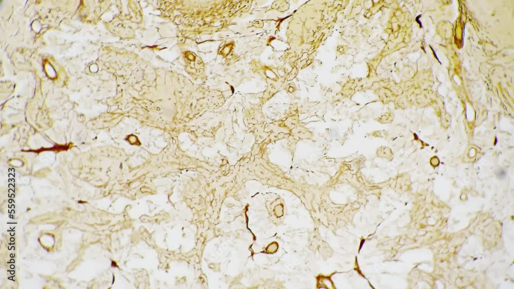 Reticular tissue of lymph node of the human being under microscope 100x ...