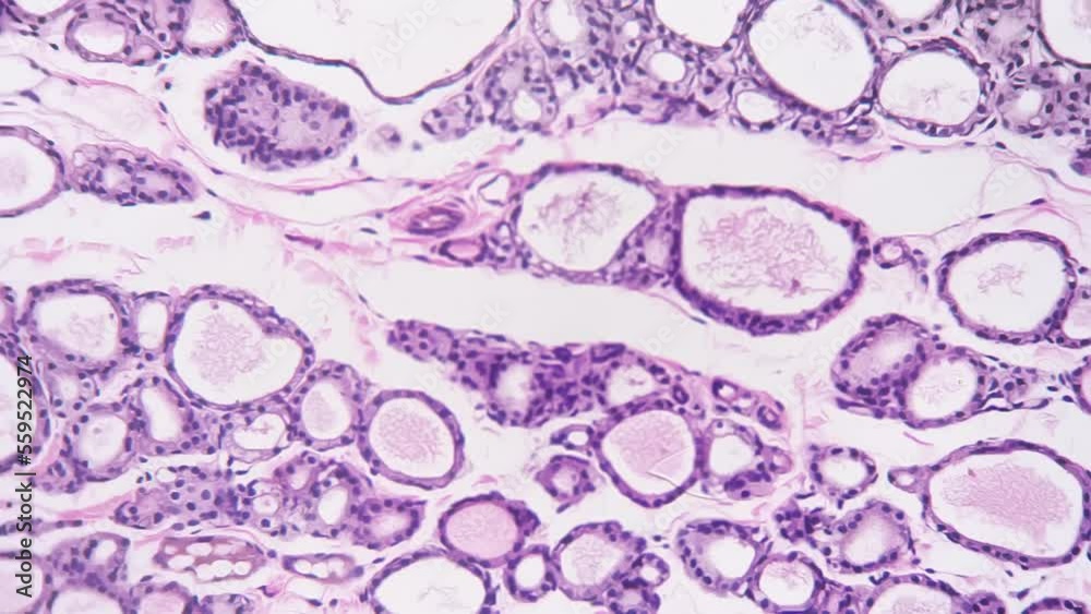 Human parathyroid glands magnified in 200x times against white ...