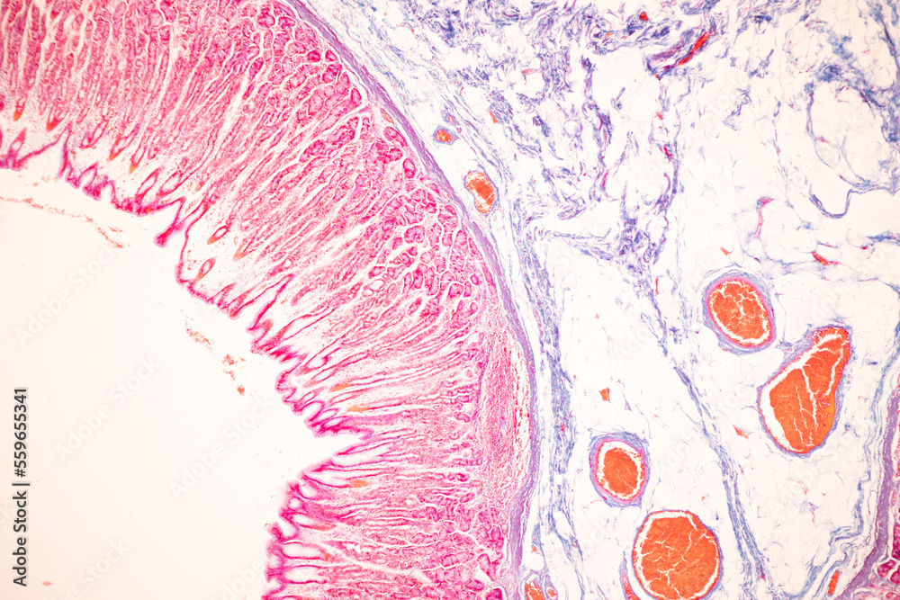 Tissue of Small intestine (Duodenum), Large intestine Human and Stomach ...