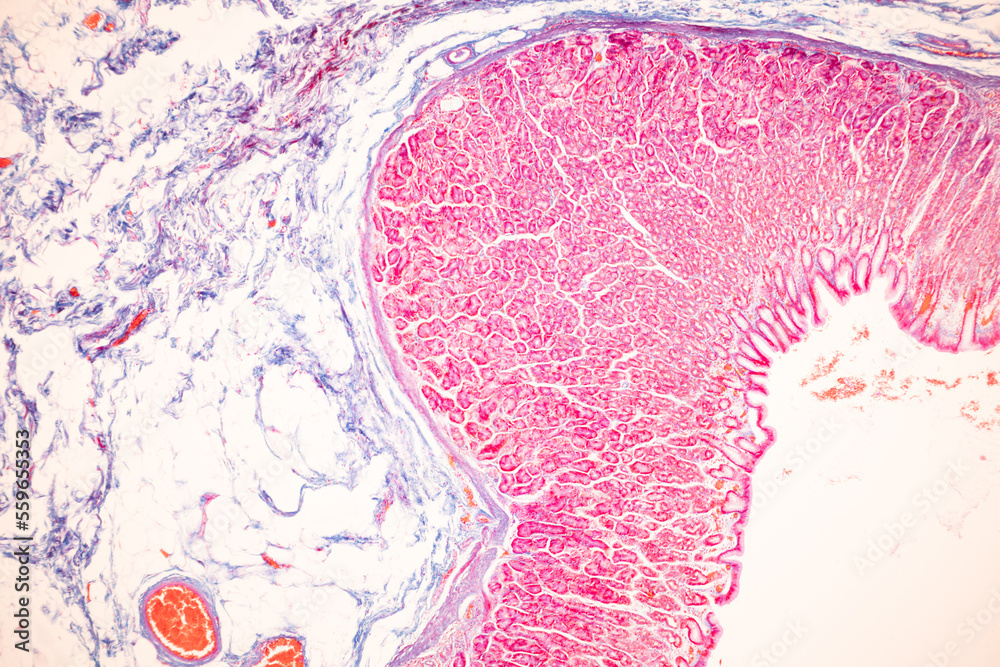 Tissue of Small intestine (Duodenum), Large intestine Human and Stomach ...
