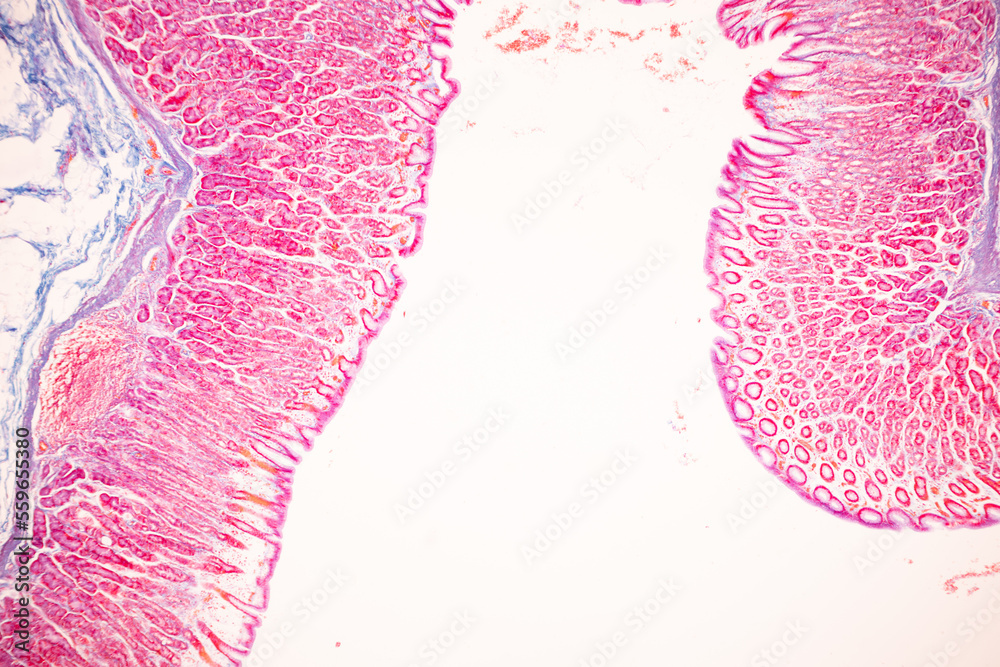 Tissue of Small intestine (Duodenum), Large intestine Human and Stomach ...