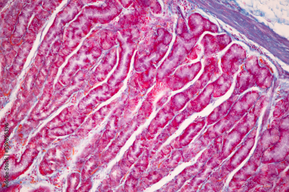 Tissue of Small intestine (Duodenum), Large intestine Human and Stomach ...