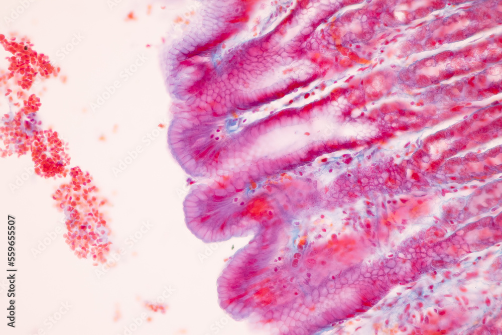 Tissue of Small intestine (Duodenum), Large intestine Human and Stomach ...