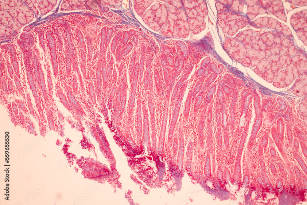 Tissue of Small intestine (Duodenum), Large intestine Human and Stomach ...
