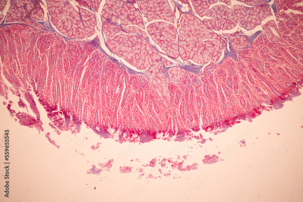 Tissue of Small intestine (Duodenum), Large intestine Human and Stomach ...