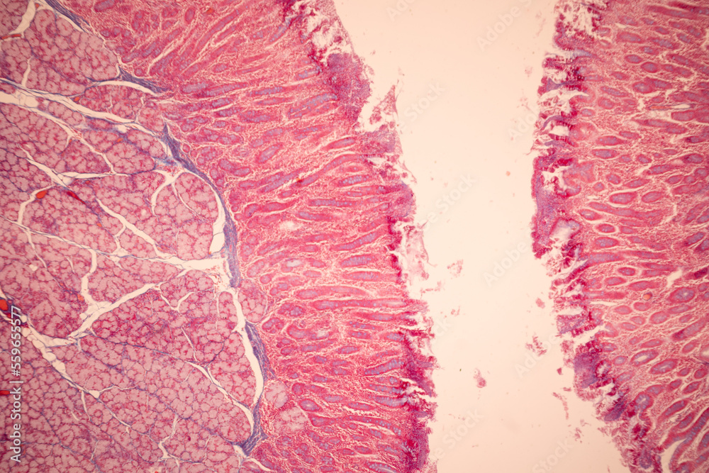 Tissue of Small intestine (Duodenum), Large intestine Human and Stomach ...