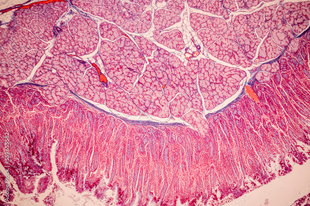 Tissue of Small intestine (Duodenum), Large intestine Human and Stomach ...
