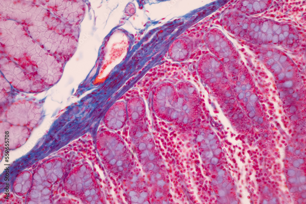 Tissue of Small intestine (Duodenum), Large intestine Human and Stomach ...
