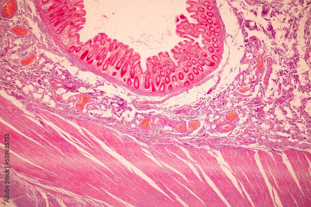 Póster Tissue of Small intestine (Duodenum), Large intestine Human and ...